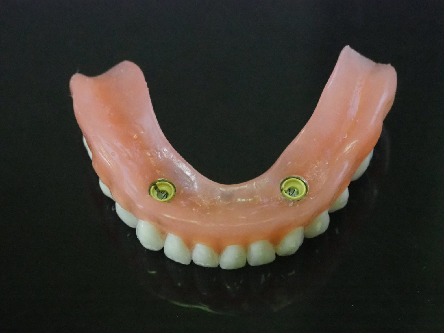 proteza na implantach - Protetyka