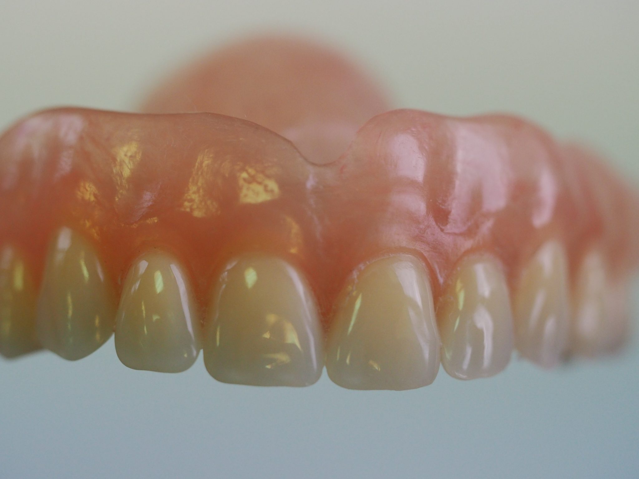 proteza acronowa - Protetyka